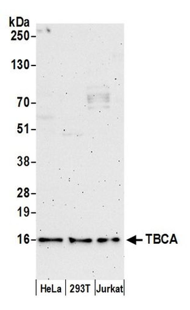 TBCA Polyclonal Antibody (A305-552A)