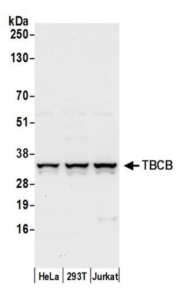 TBCB Polyclonal Antibody (A305-465A-T)