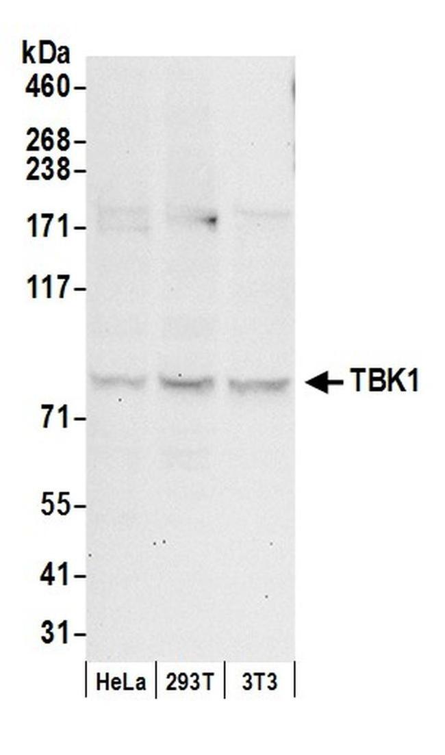 TBK1 Polyclonal Antibody (A300-093A-T)