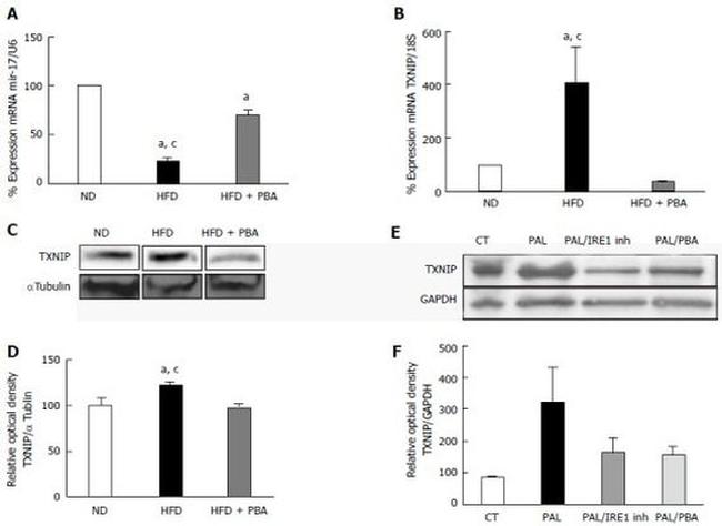 TXNIP Antibody (40-3700)