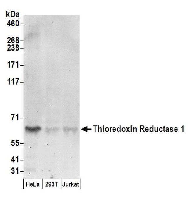 Thioredoxin Reductase 1/TXNRD1/TRXR1 Polyclonal Antibody (A304-791A)
