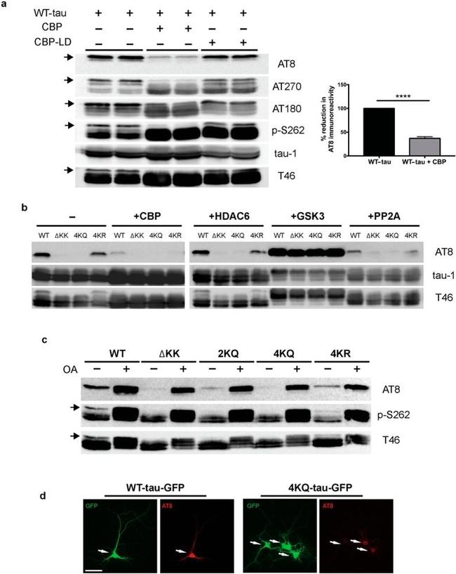Phospho-Tau (Ser396) Antibody (44-752G)