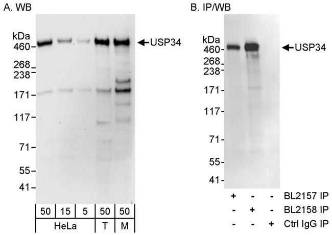USP34 Antibody (A300-824A)