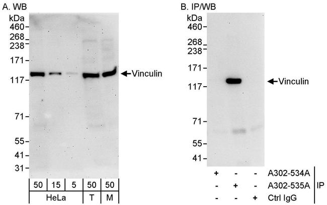 Vinculin Antibody (A302-535A)