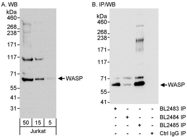 WASP Polyclonal Antibody (A300-581A)