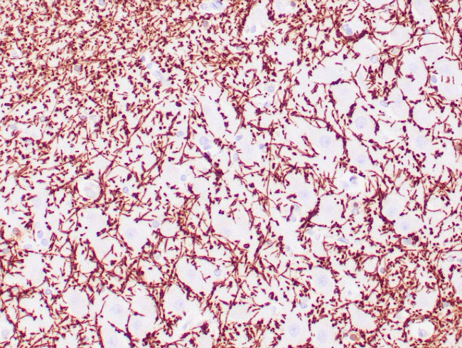 Myelin basic protein Recombinant Monoclonal Antibody (ZR109) (Z2411RP)