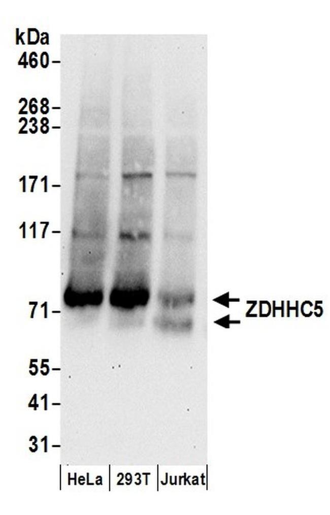 ZDHHC5 Polyclonal Antibody (A304-652A)