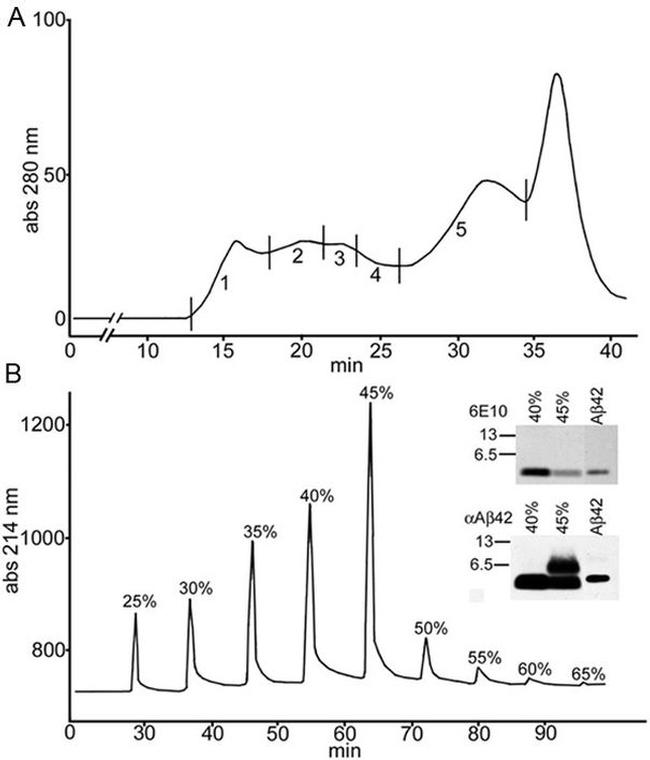 beta Amyloid (1-42) Antibody (44-344)