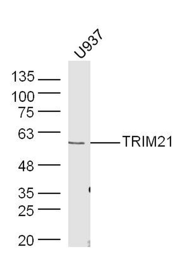 TRIM21 Polyclonal Antibody (BS-0635R)
