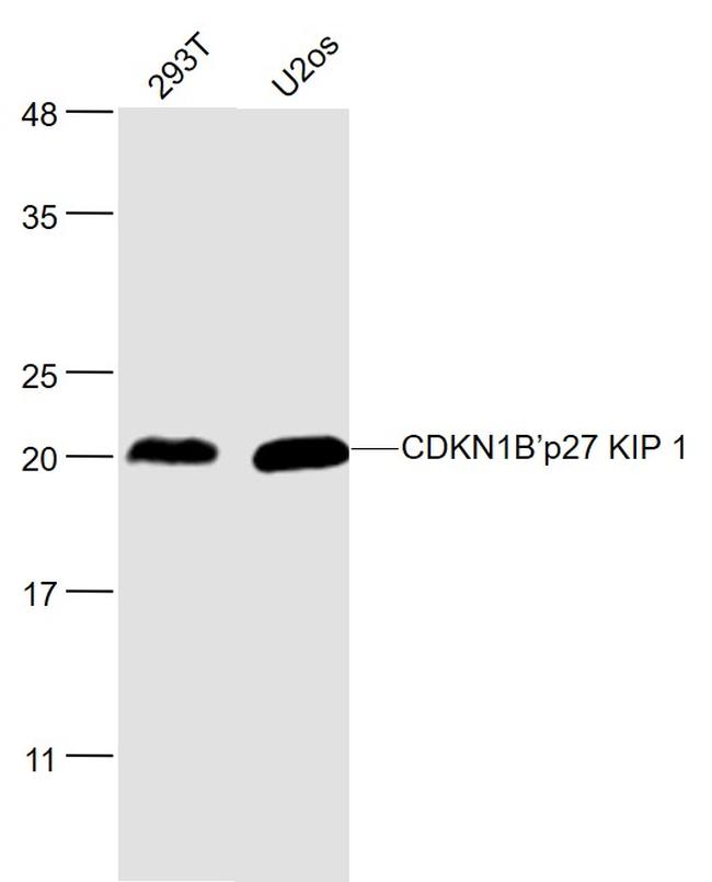CDKN1B Polyclonal Antibody (BS-0742R)