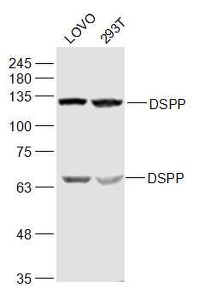 DSPP Polyclonal Antibody (BS-10316R)
