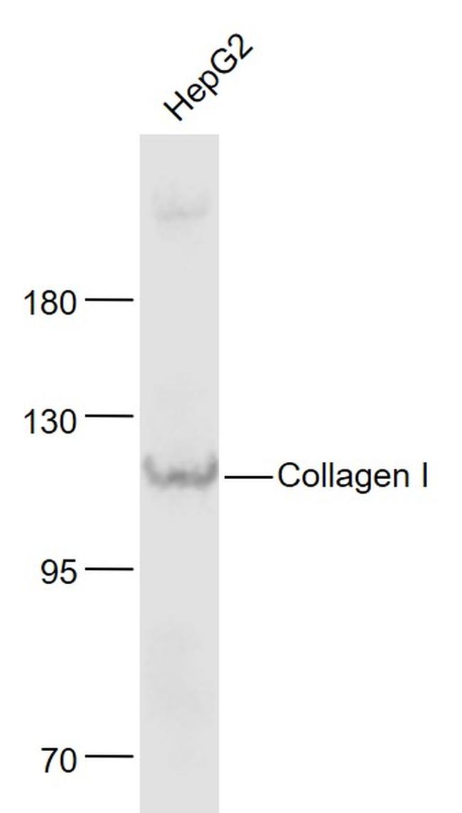 Collagen 1 Antibody (BS-10423R)