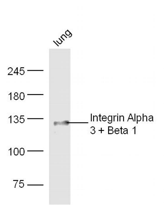 Integrin Alpha 3 + Beta 1 Antibody (BS-1057R)