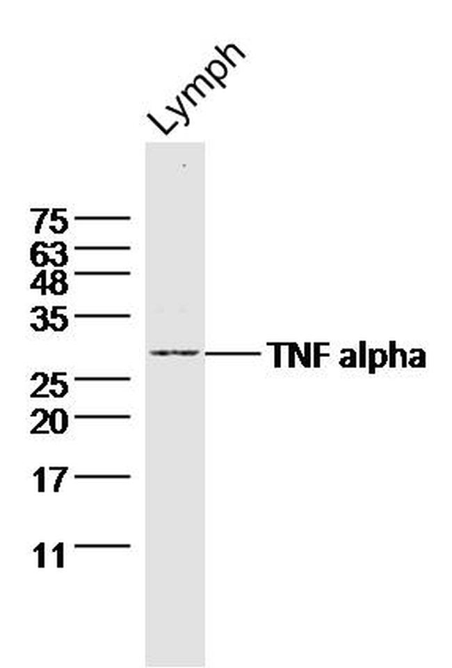 TNF alpha Polyclonal Antibody (BS-10802R)