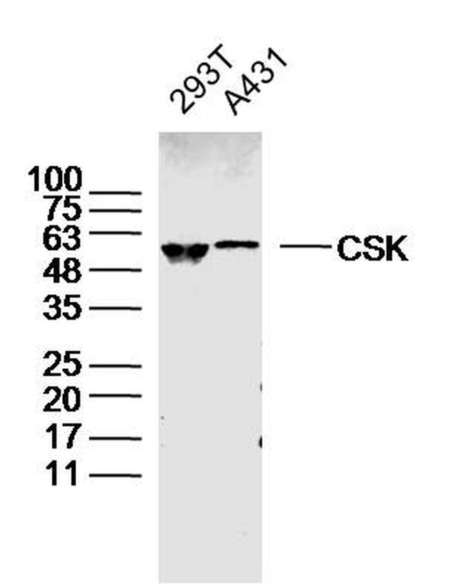 CSK Antibody (BS-12941R)
