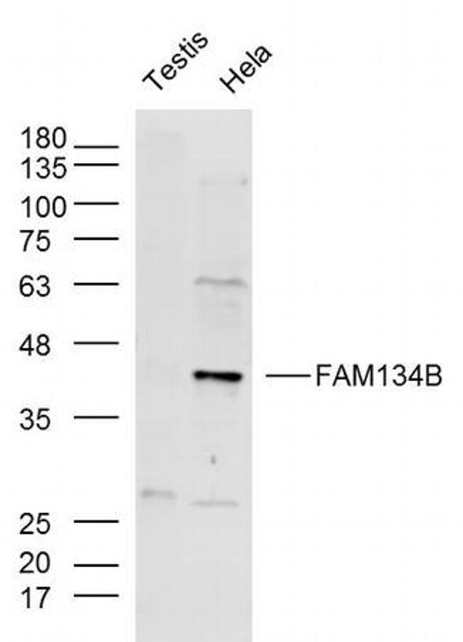 FAM134B Polyclonal Antibody (BS-13136R)