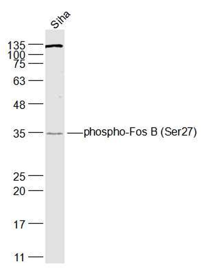 Phospho-FosB (Ser27) Polyclonal Antibody (BS-13198R)