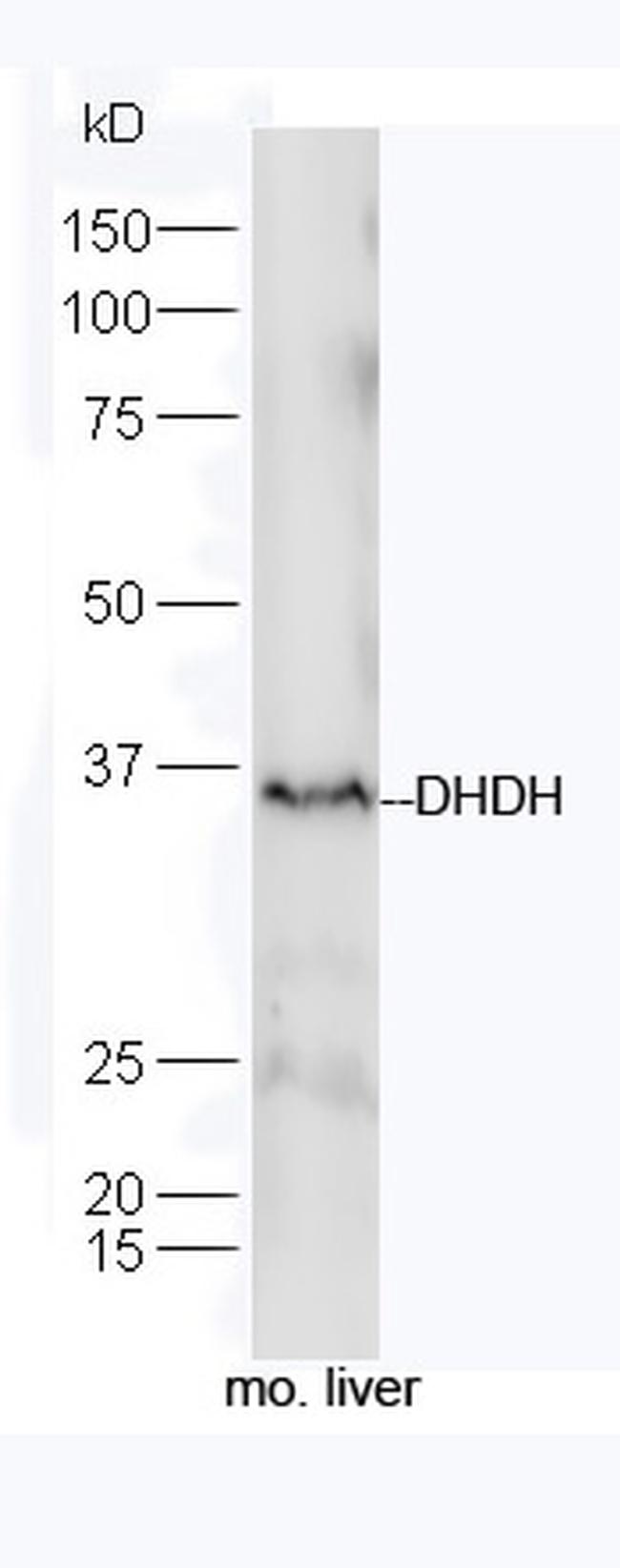 DHDH Antibody (BS-14302R)