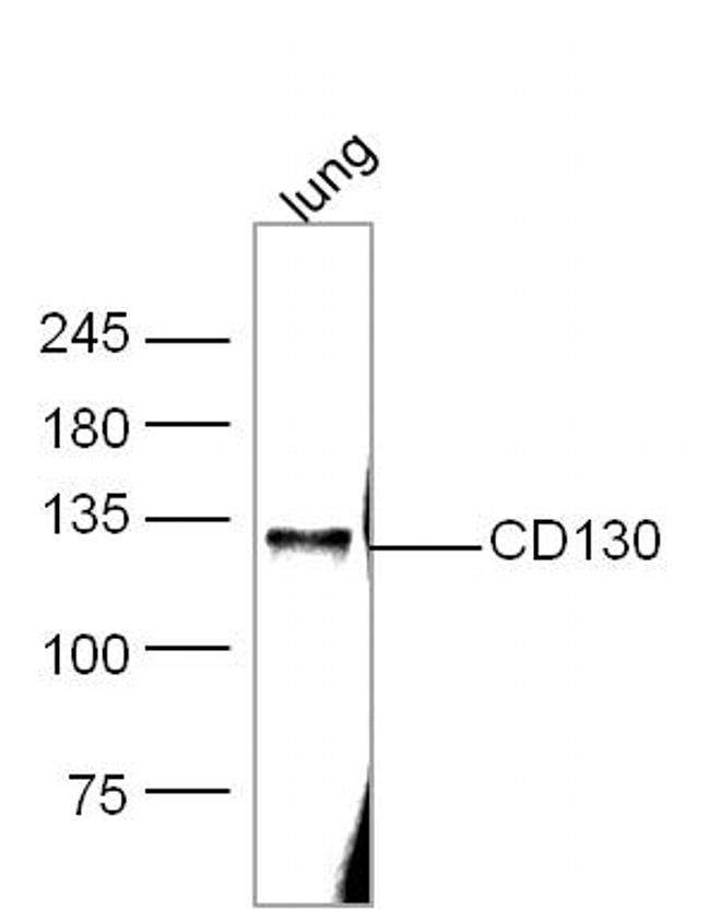 IL-6R Beta/CD130/gp130 Antibody (BS-1459R)