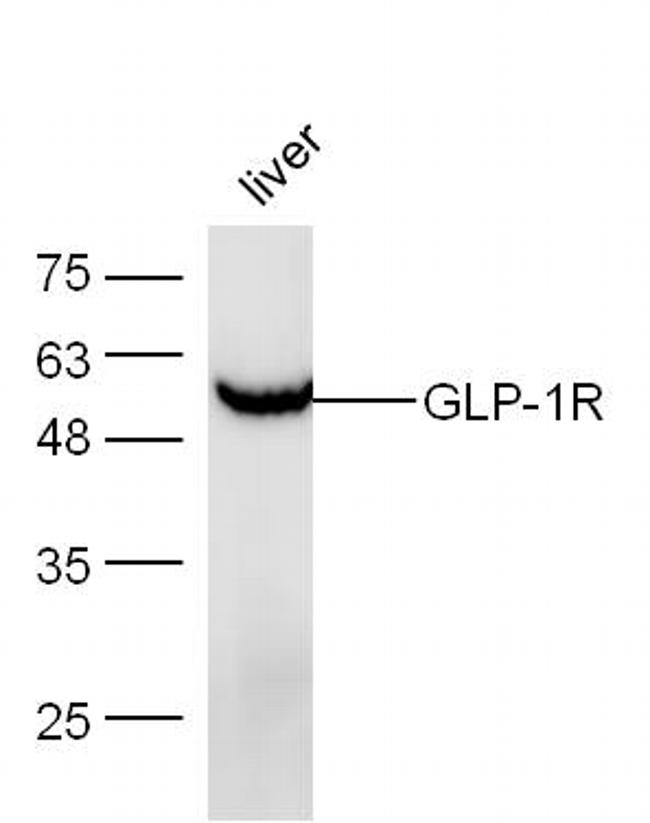 GLP-1R Antibody (BS-1559R)