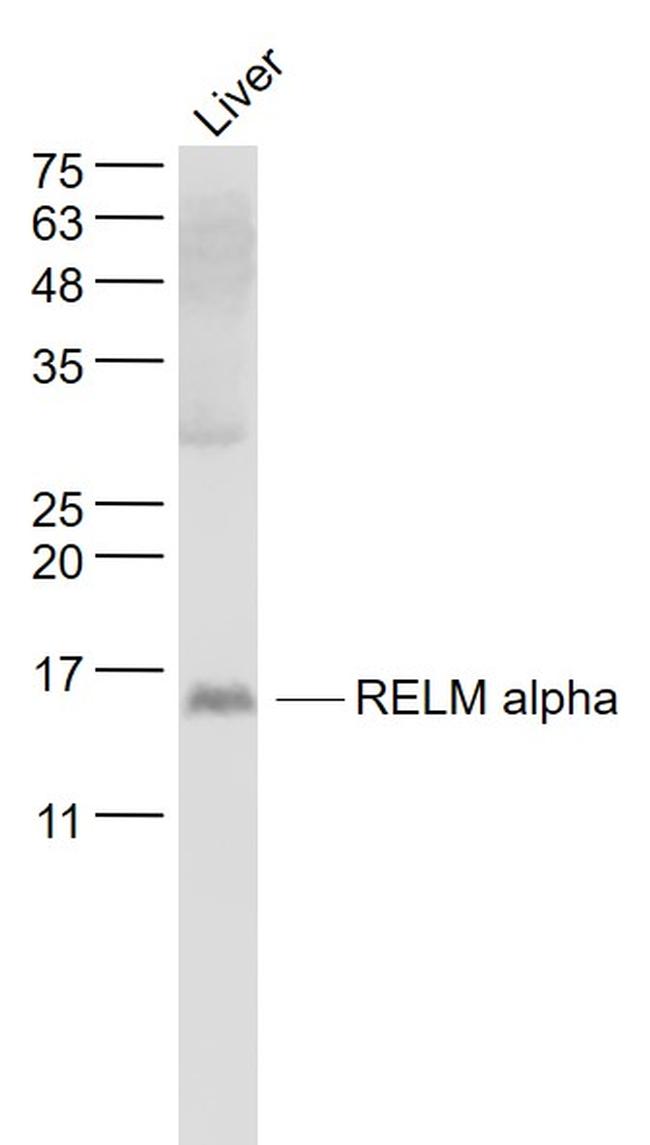 RELMa/RELM alpha Polyclonal Antibody (BS-1884R)