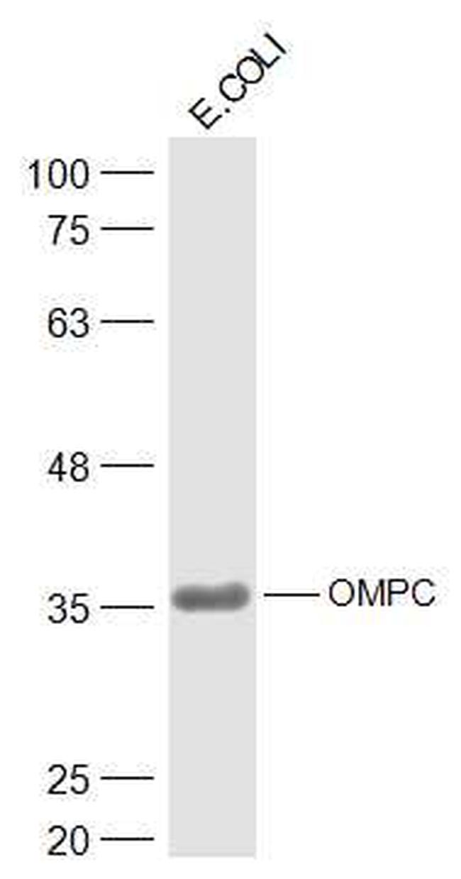 OMPC Polyclonal Antibody (BS-20213R)