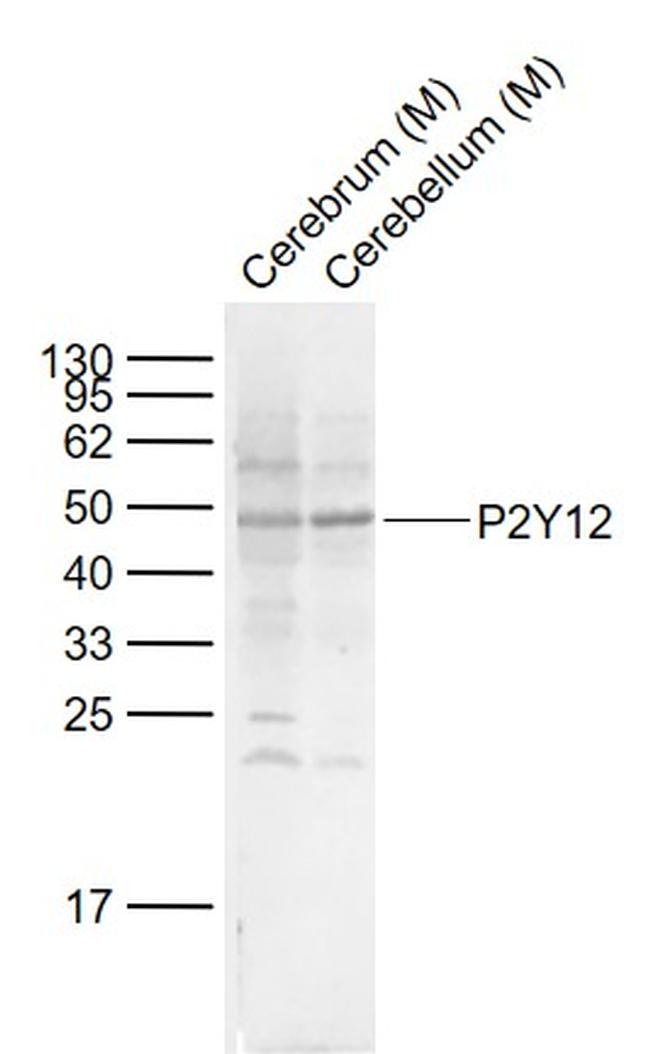 P2Y12 Polyclonal Antibody (BS-21503R)