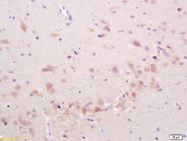 Phospho-STMN2/SCG10 (Ser50) Polyclonal Antibody (BS-2299R)