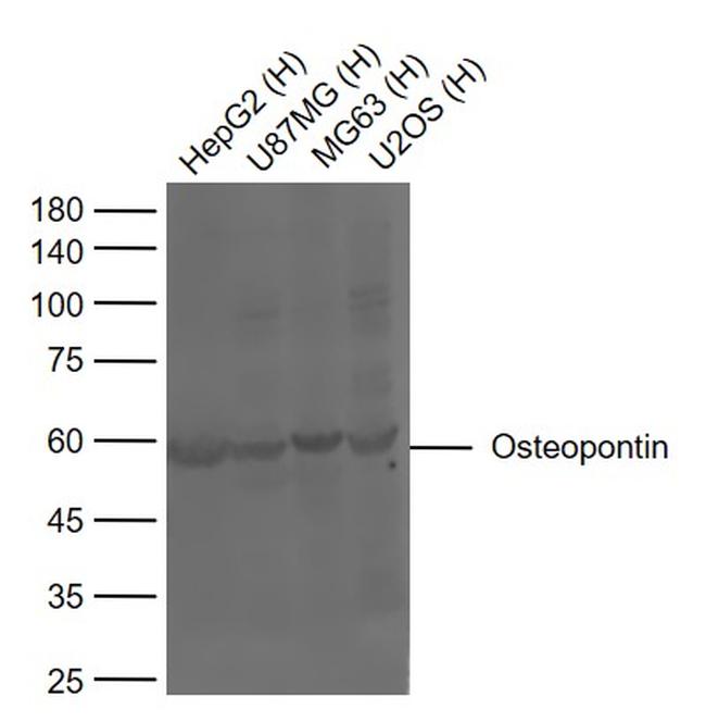 Osteopontin Polyclonal Antibody (BS-23258R)