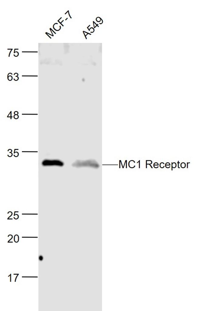 MC1 Receptor Polyclonal Antibody (BS-23517R)