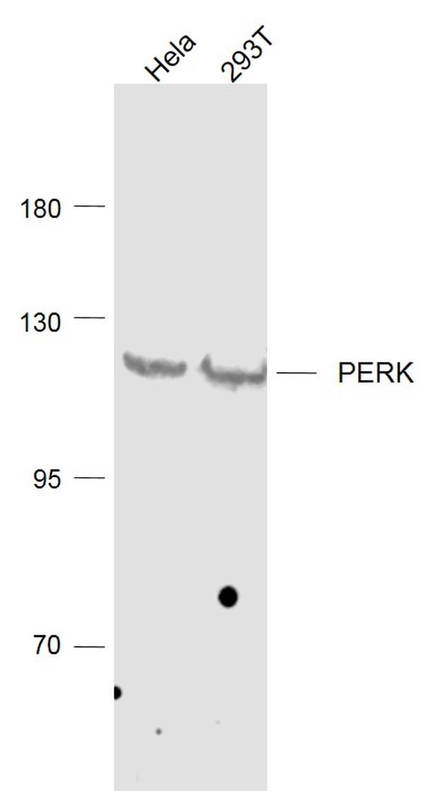 PERK Antibody (BS-2469R)