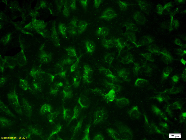 Langerin/CD207 Polyclonal Antibody (BS-2650R)