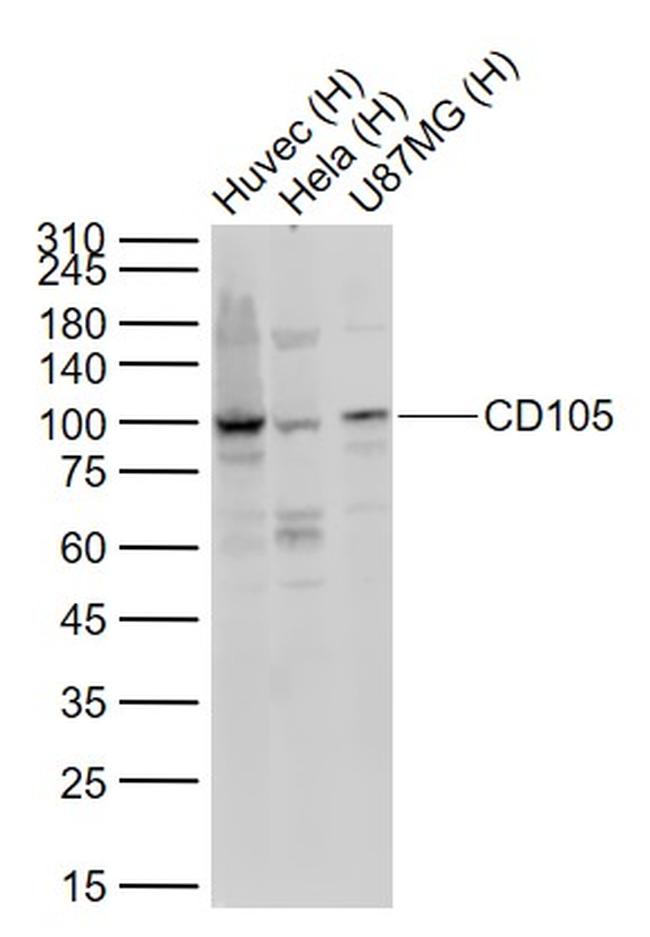CD105 Polyclonal Antibody (BS-34063R)
