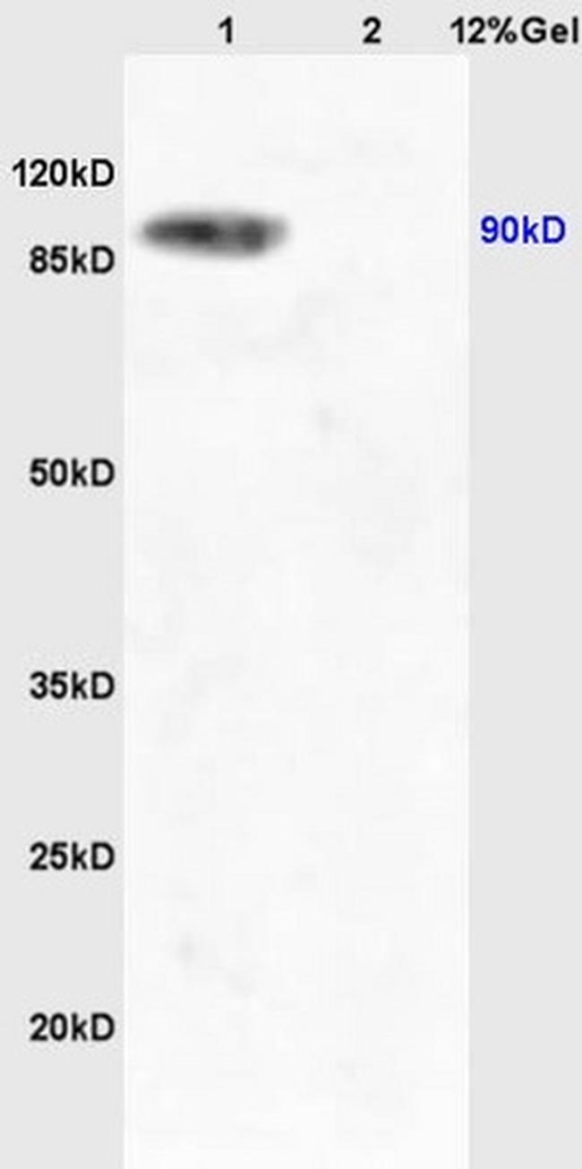 Phospho-TrkA (Tyr496) Polyclonal Antibody (BS-3456R)