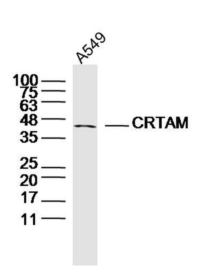 CRTAM Antibody (BS-4957R)