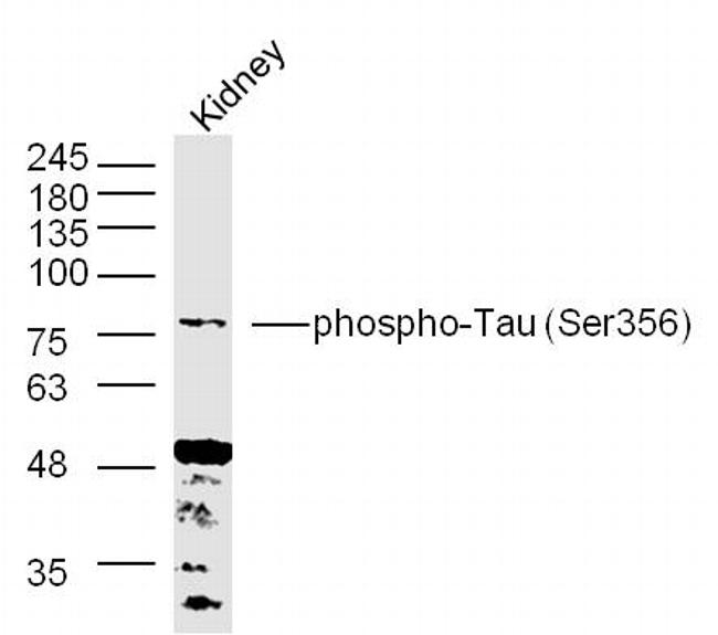 Phospho-Tau protein (Ser356) Antibody (BS-5421R)