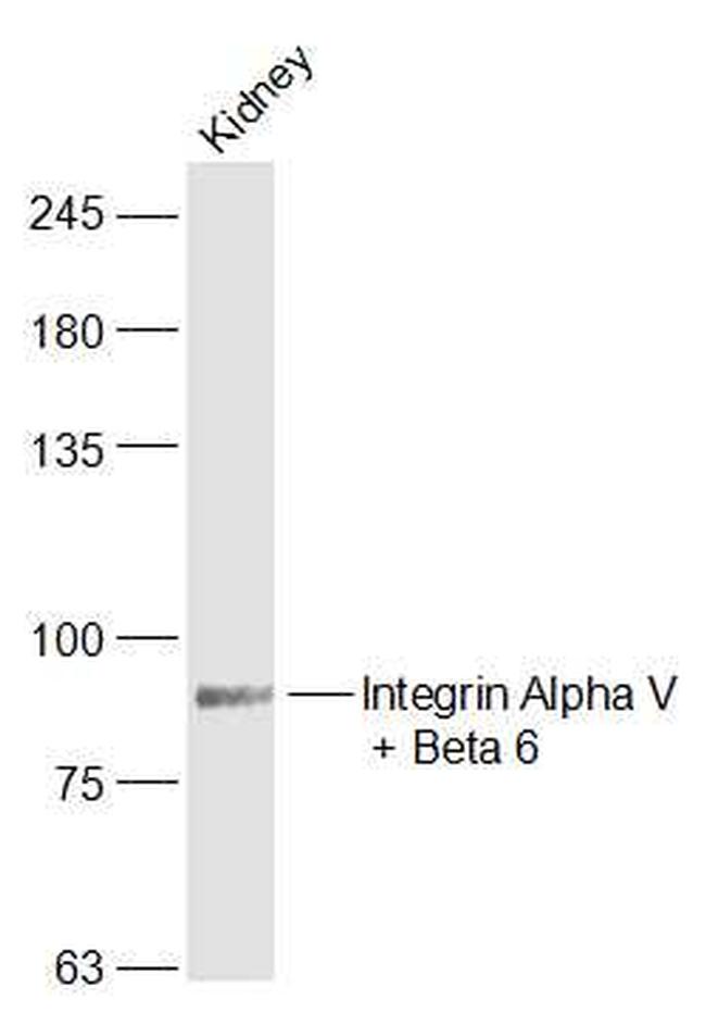 Integrin Alpha V + Beta 6 Antibody (BS-5791R)