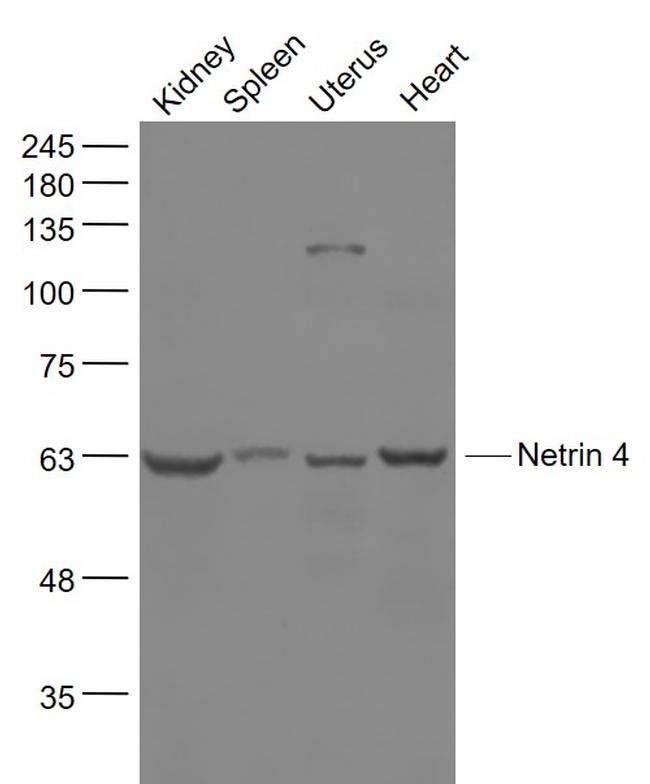 Netrin 4 Antibody (BS-6711R)