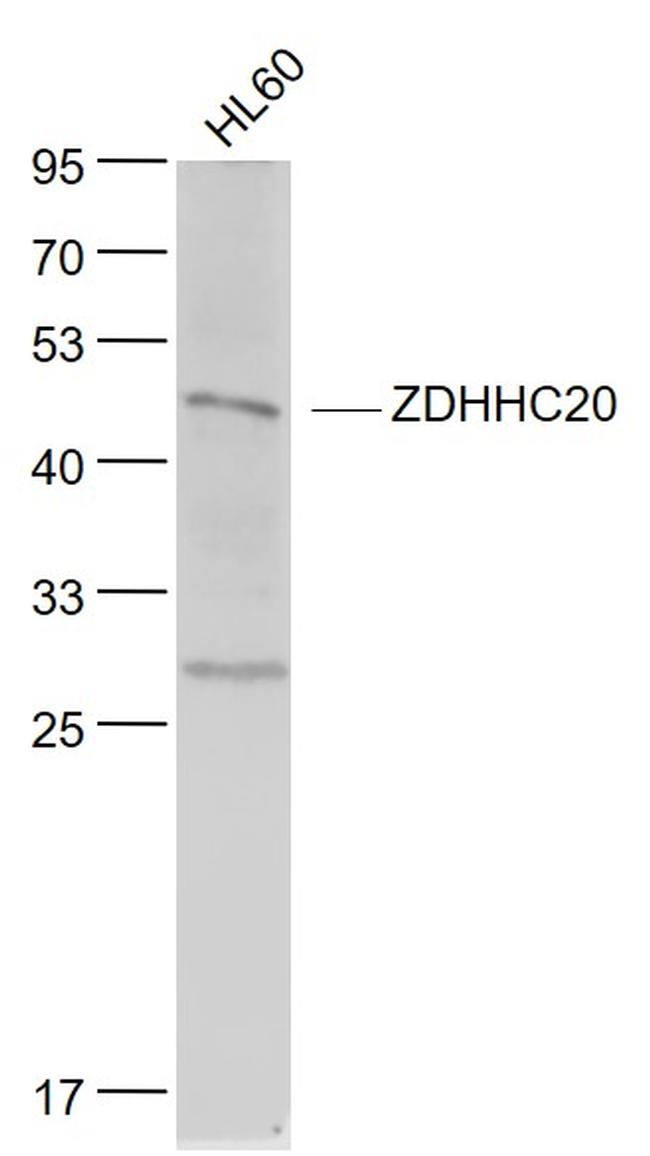 DHHC-20 Polyclonal Antibody (BS-7418R)