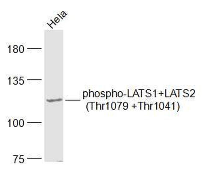 Phospho-LATS1 (Thr1079) Antibody (BS-7913R)