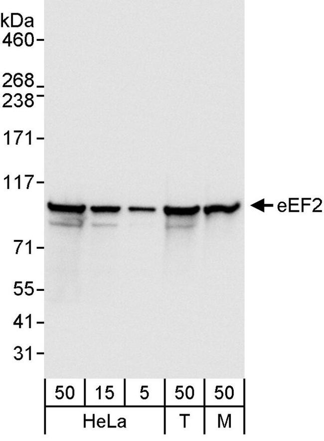 eEF2 Polyclonal Antibody (A301-688A)