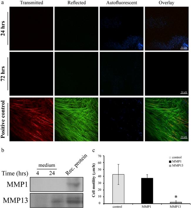 MMP1 Antibody (MA5-15872)