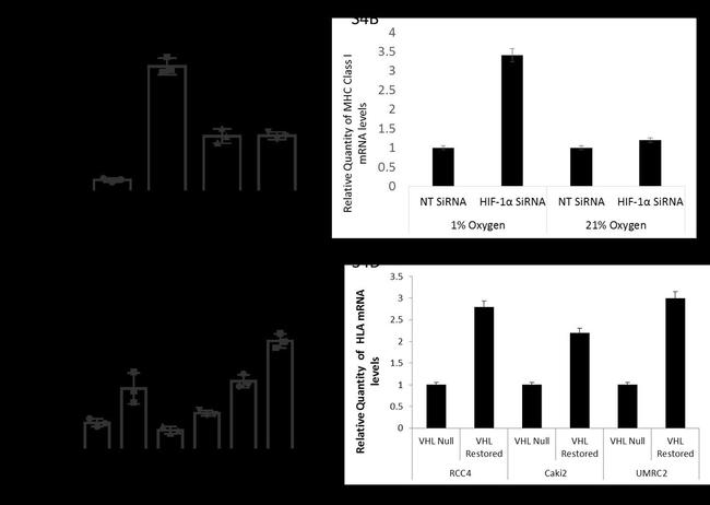 HLA-ABC Antibody (14-9983-82)