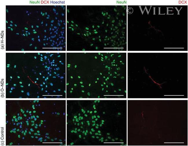 Doublecortin Antibody (48-1200)