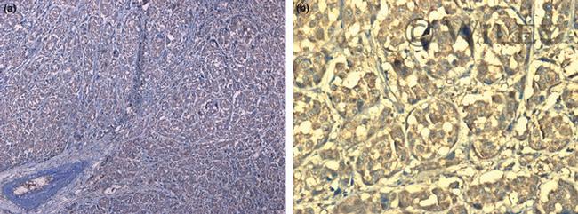 GRPR Antibody (OPA1-15619)