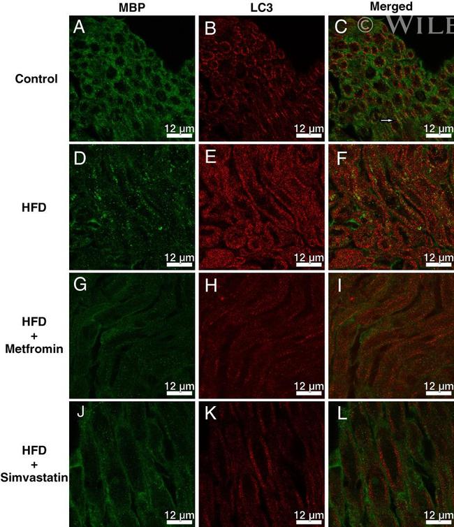 MBP Antibody (MA5-15922)