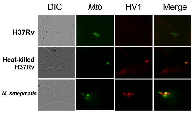 HVCN1 Antibody (PA5-21008)
