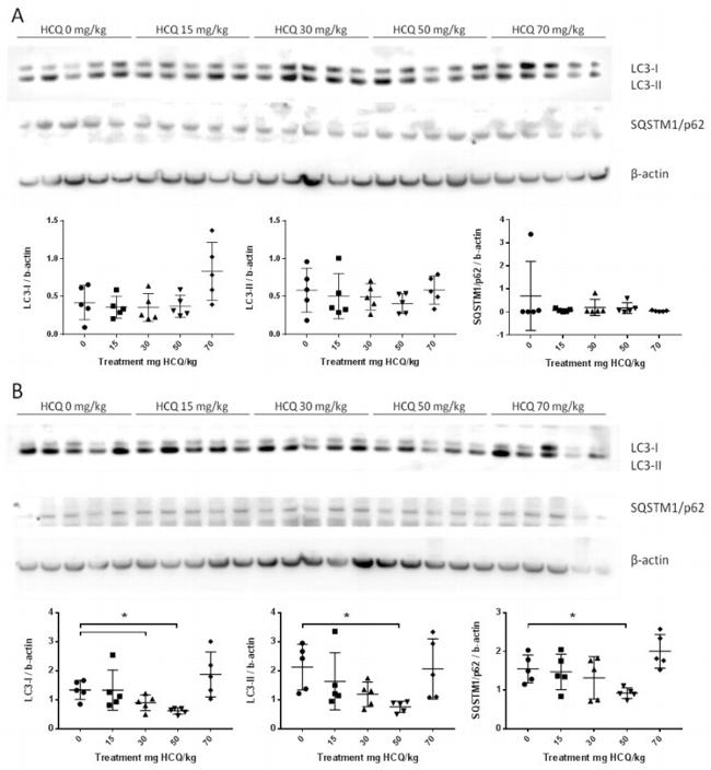 LC3B Antibody (PA1-46286)