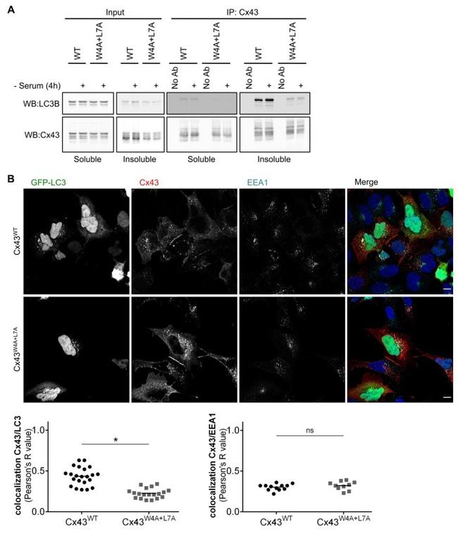 LC3B Antibody (PA1-16930)