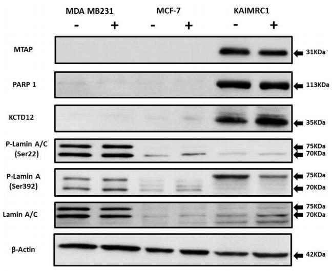 PARP1 Antibody (436400)